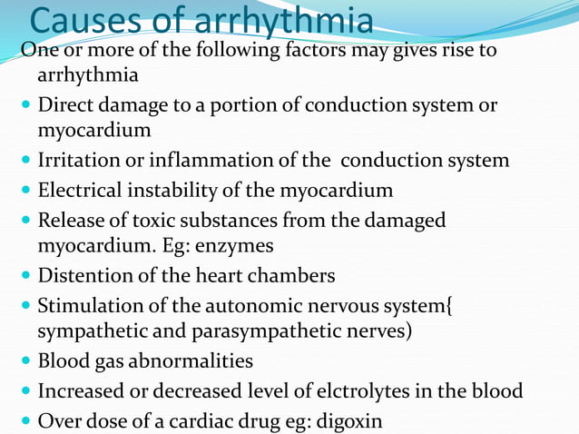 arrythmias.ppt