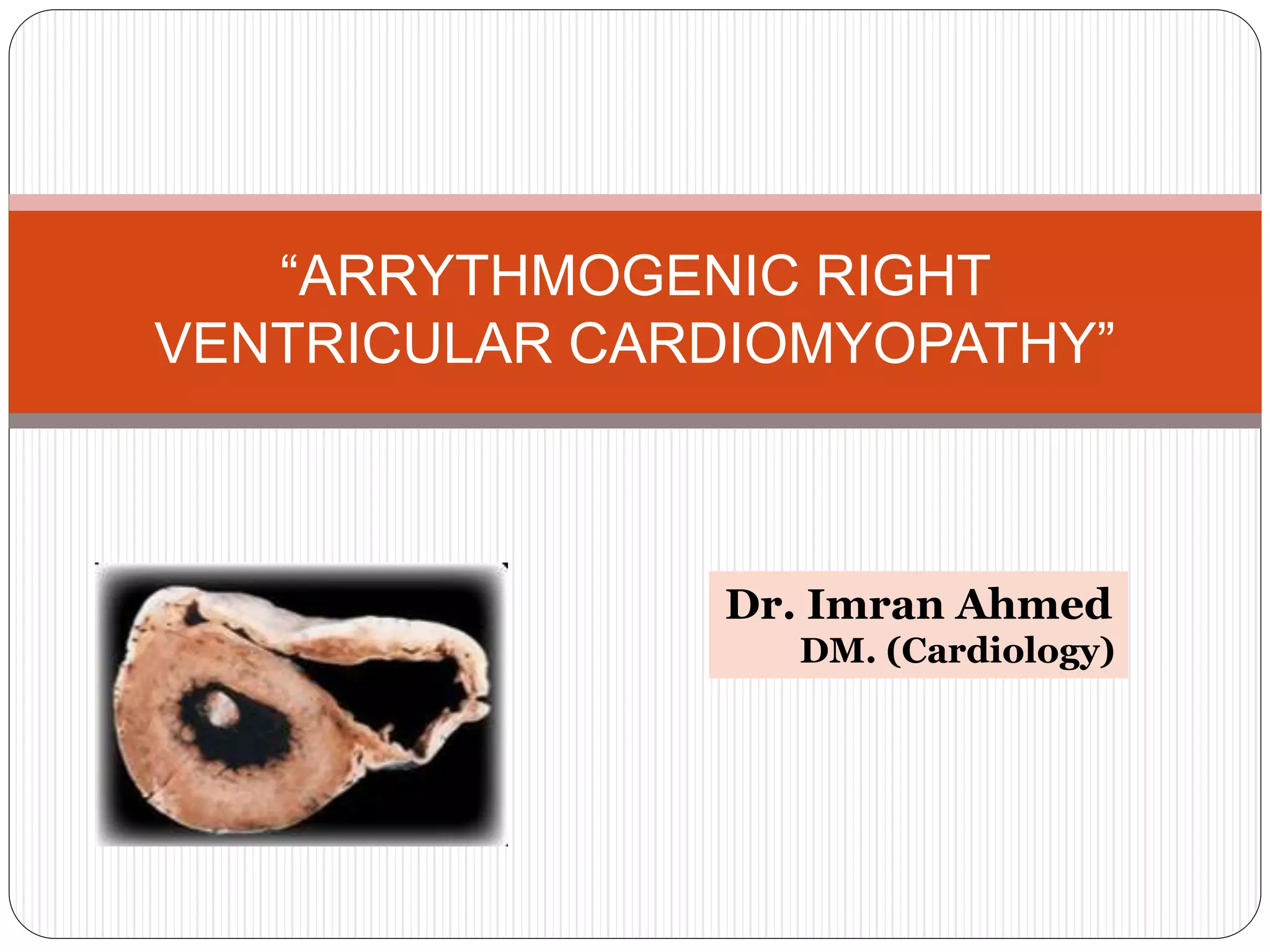 ARVD (Arrythmogenic right ventricular cardiomyopathy) - updated task ...