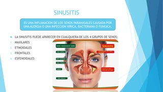 INFECCIONES DE VIAS AEREAS SUPERIORES | PPTX