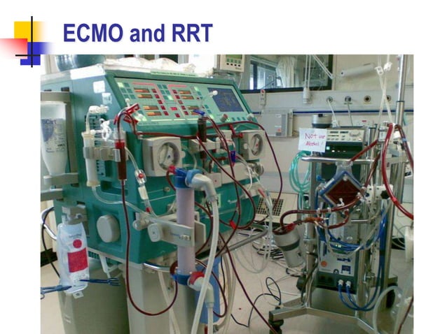 Use of ECMO in H1N1 Influenza Pneumonia.ppt