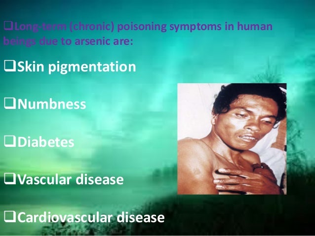 Arsenic Poisoning