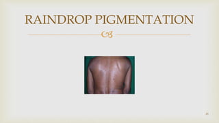 ARSENIC-AIIMS KALYANI.pptx