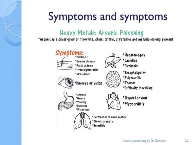 Arsenic / Sankiya / Rodenticide (irritant) poisoning / toxicity | PPT