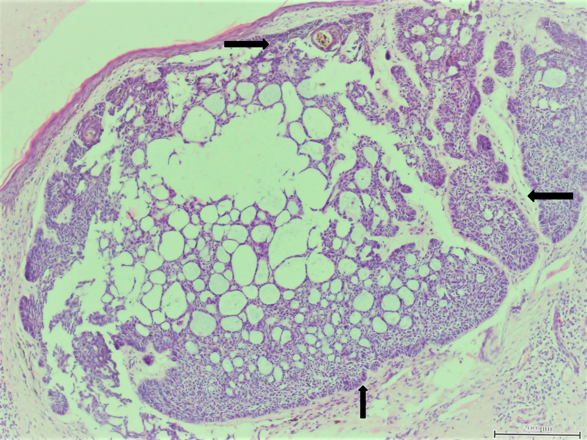 Arsenicosis- (2).powerpoint presentation | PPT