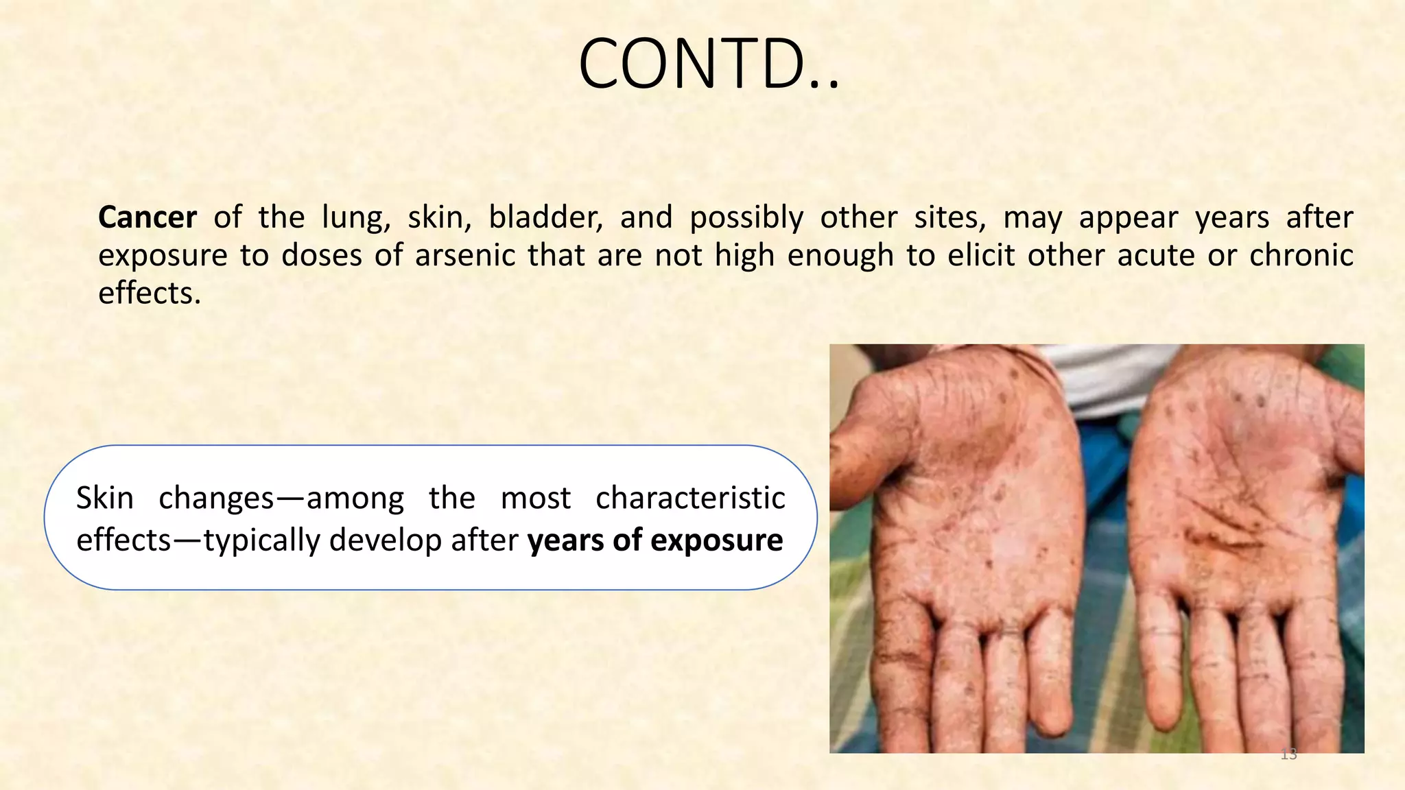 Arsenic poisoning | PPTX