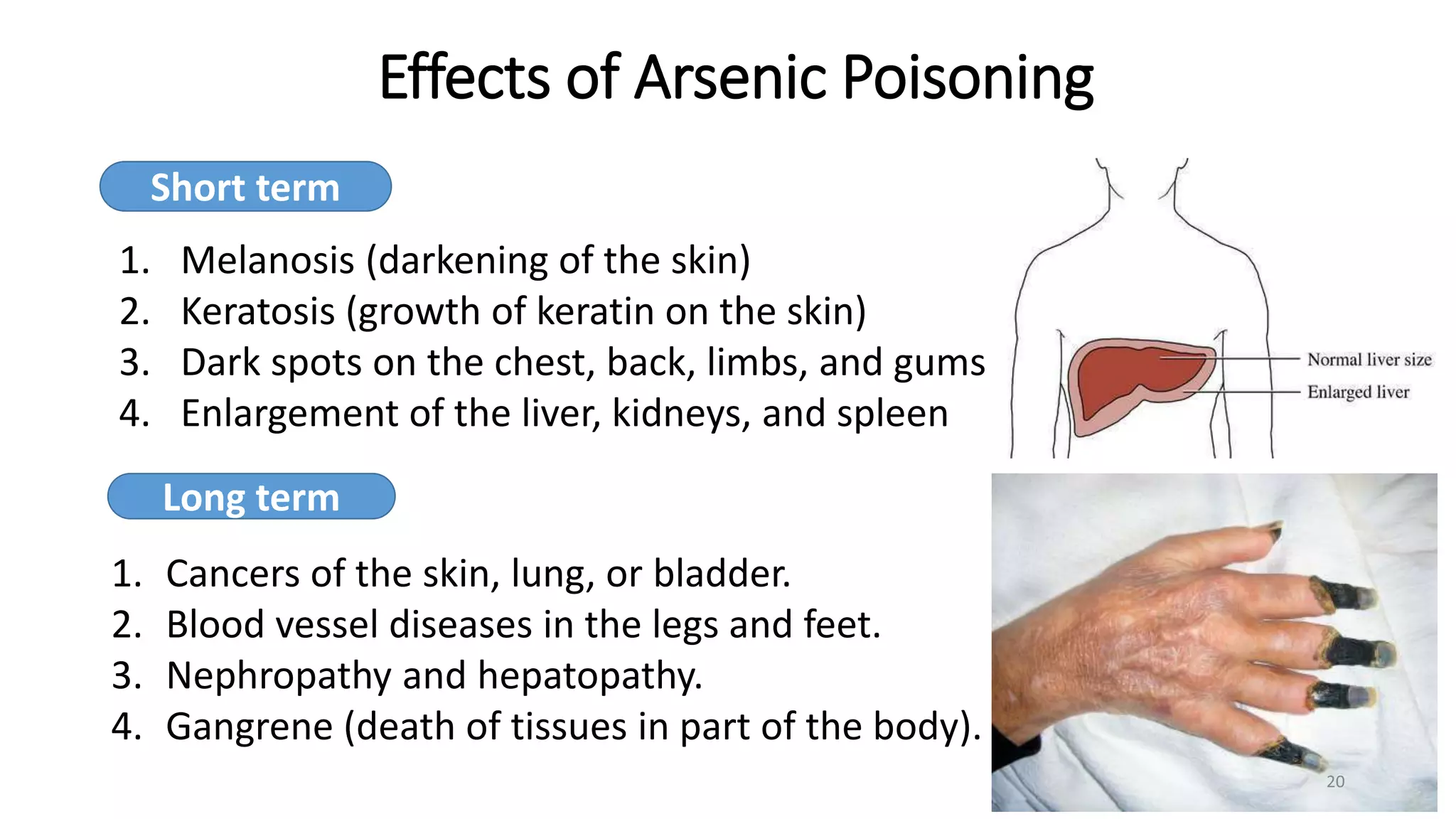 Arsenic poisoning | PPTX