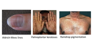 ARSENIC POISONING - A FORENSIC MEDICINE PRESENTATION | PPTX