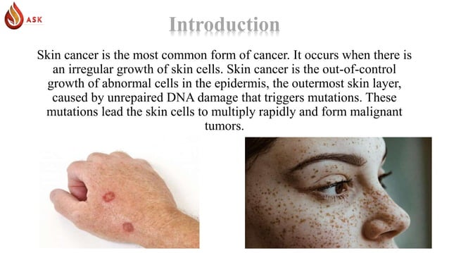 Skin Cancer | PPTX | Skin and Dermatology | Diseases and Conditions