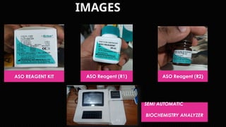 Antistreptolysin O Test (Turbidimetric method) pptx | PPTX