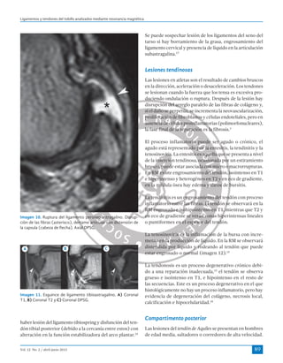 Art. ligamentos y tendones del tobillo | PDF
