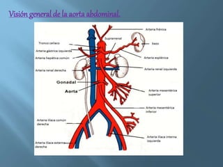 Arterias Diafragmáticas Inferiores Pptx