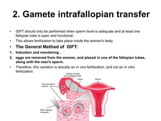 ART..... State of art | PPTX | Infertility | Reproductive Health