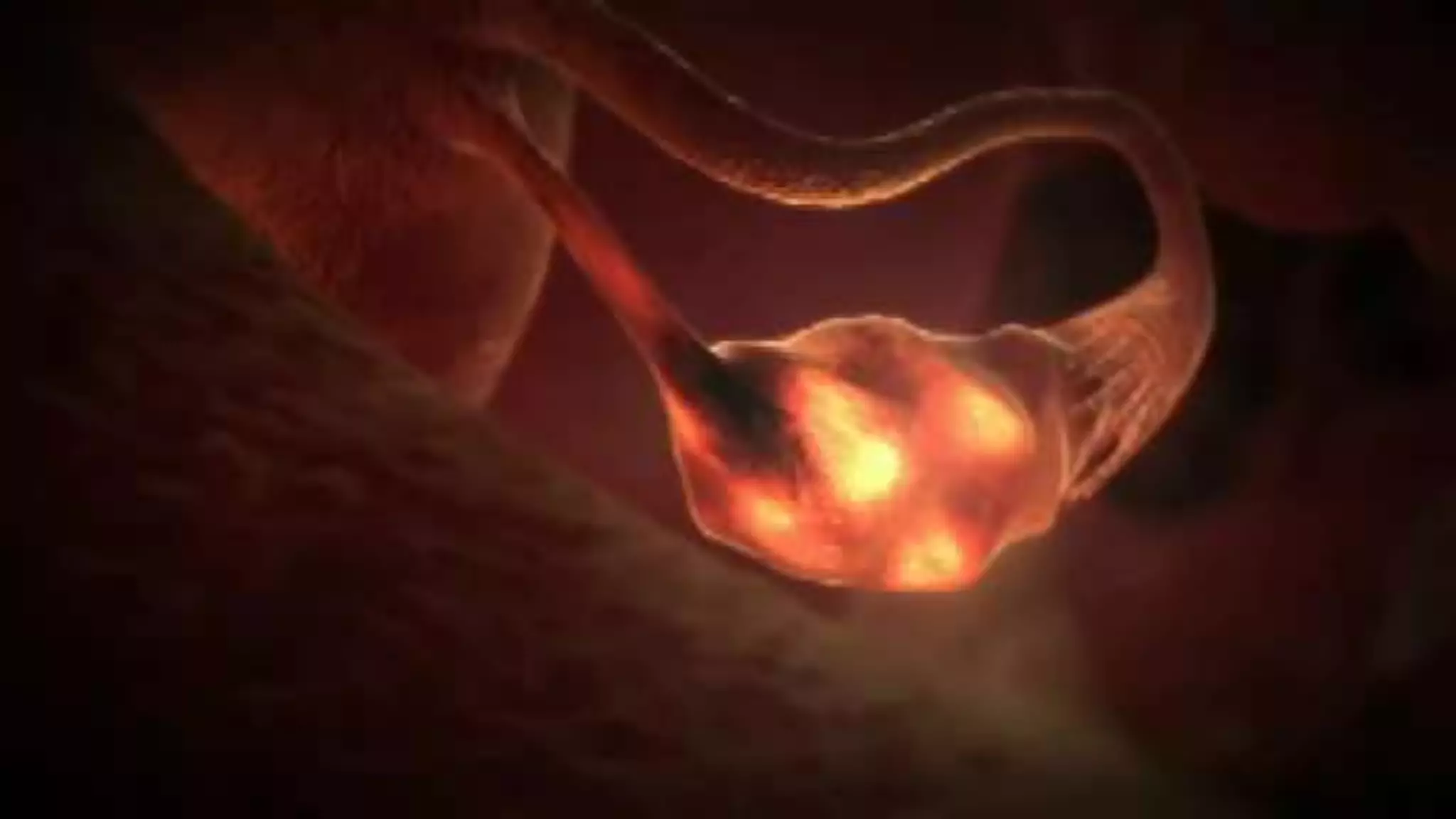 ART ( ASSISTED REPRODUCTIVE TECHNOLOGIES).THIS THE ARTIFICIAL ...