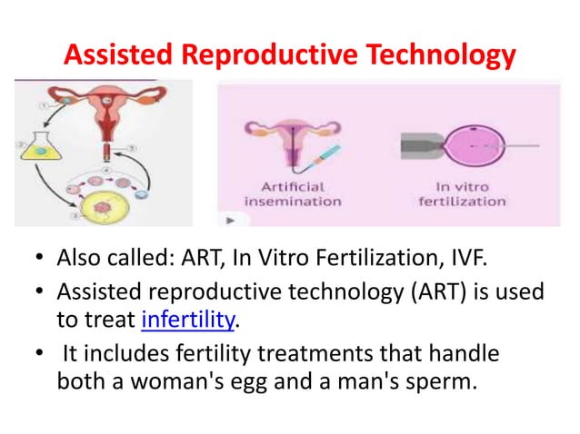 Assisted Reproductive technology (ART) | PPTX