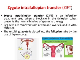 Assisted Reproductive technology (ART) | PPT