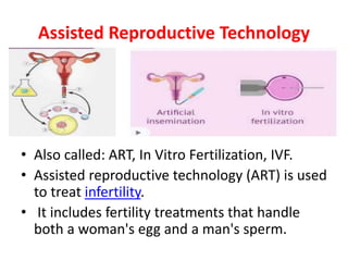 Assisted Reproductive technology (ART) | PPT