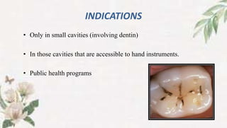 ART - Atraumatic Restorative Treatment.pptx
