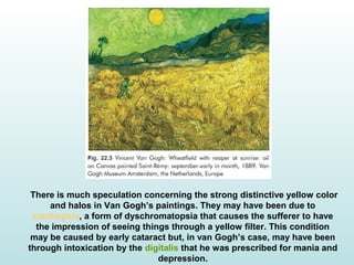 Ophthalmology & Art ! | PPT