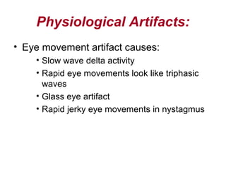 EEG Artefact | PPT