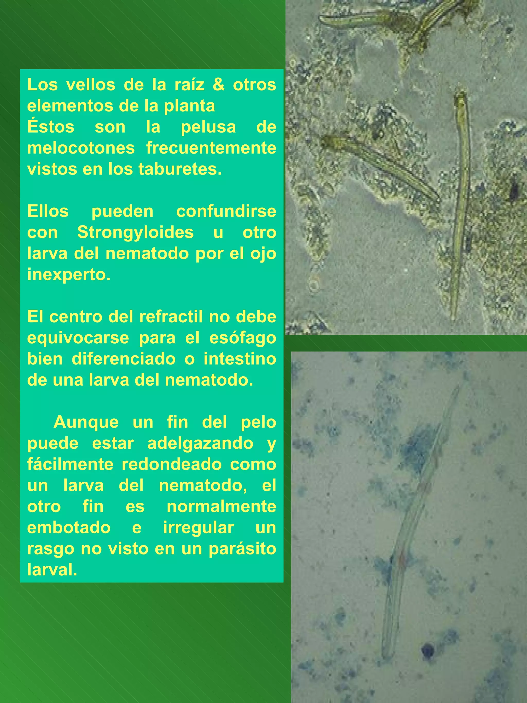 Artefactos En Coprologia | PPT