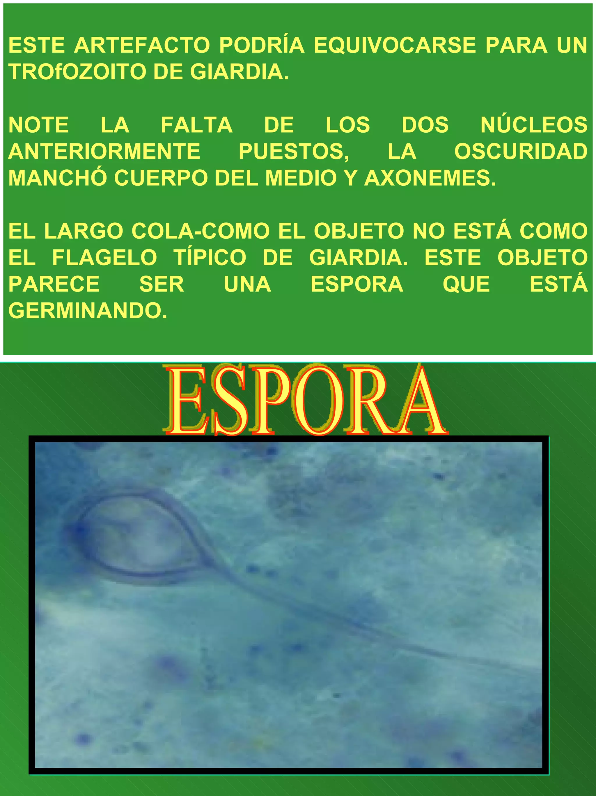 Artefactos En Coprologia | PPT