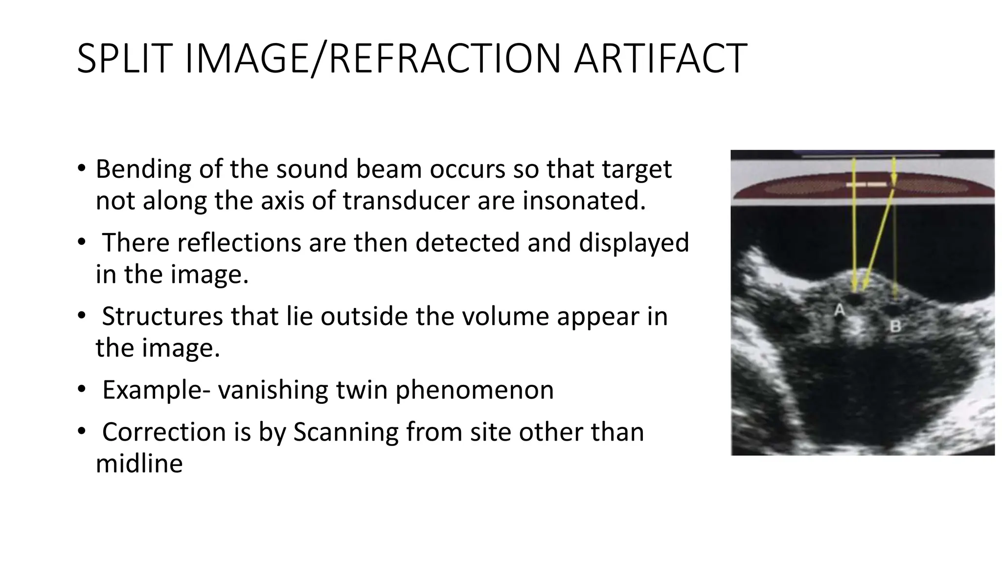 artefacts in ultrasound imaging: physics .pptx