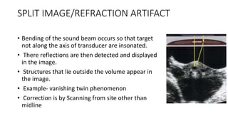 artefacts in ultrasound imaging: physics .pptx
