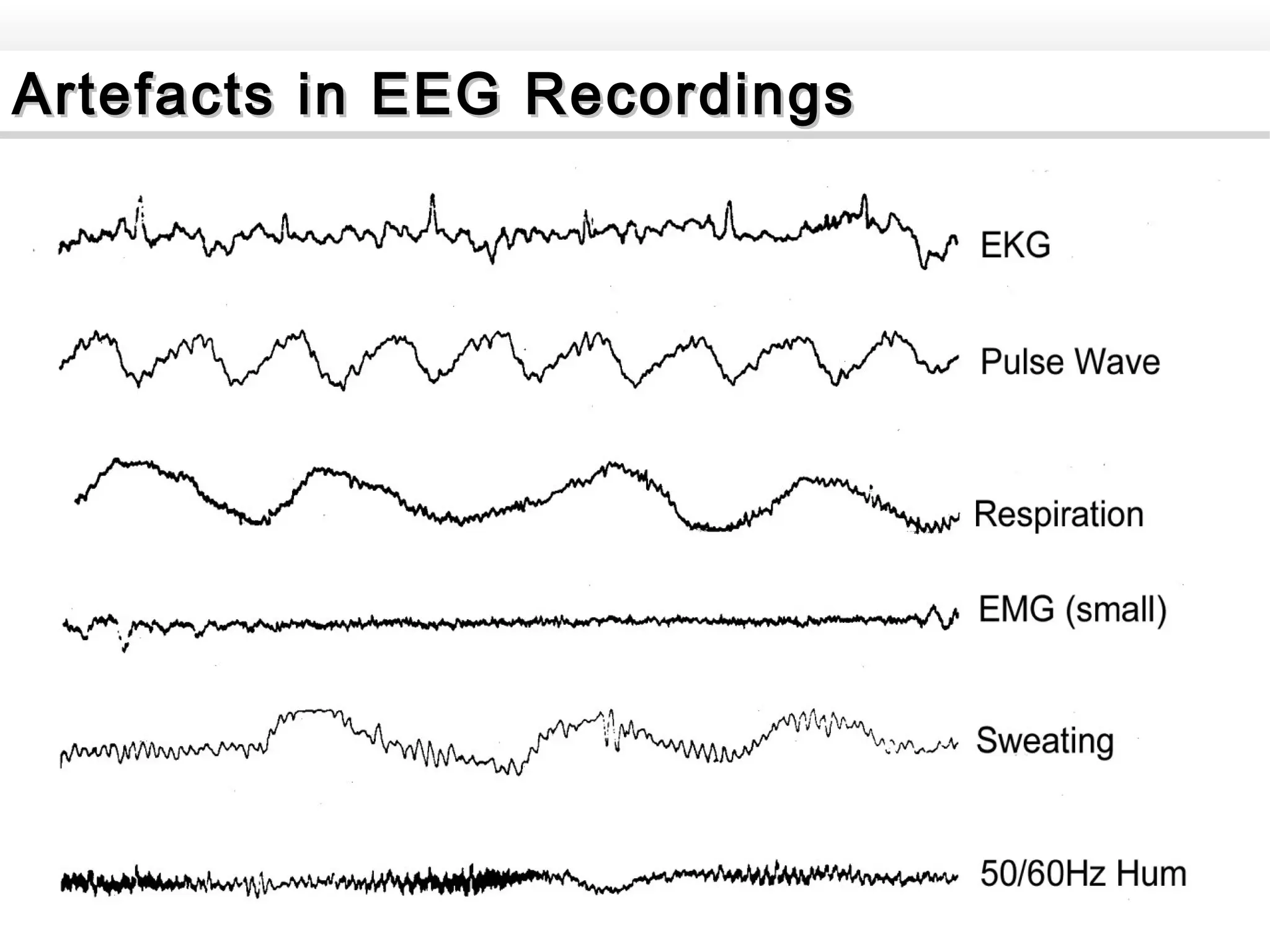 Artifacts in EEG - Recognition and differentiation | PPT