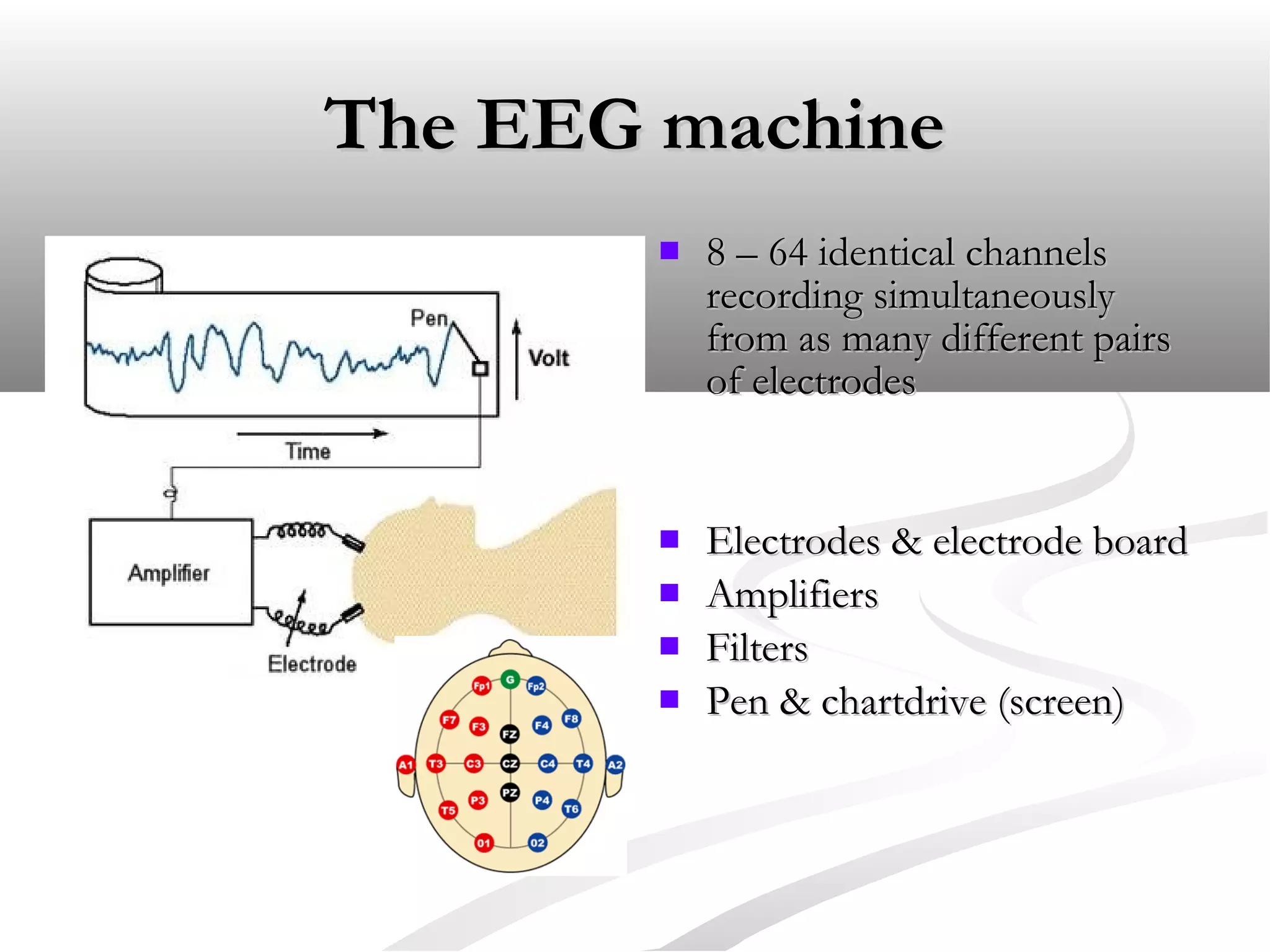 Artifacts in EEG - Recognition and differentiation | PPT