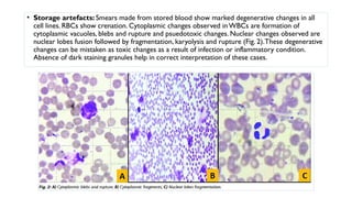 Artefacts in Haematology by pathology resident hematology topic | PPTX