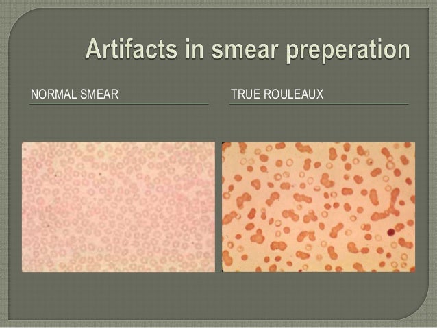 Artefacts in hemat part 2