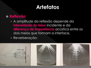 Artefatos em ultrassonografia | PPTX
