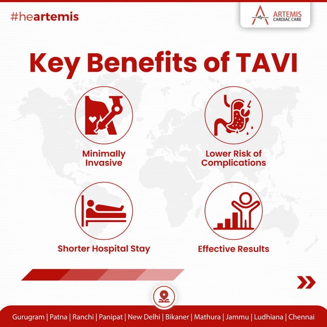 Revolutionizing Heart Care: Transcatheter Aortic Valve Implantation ...
