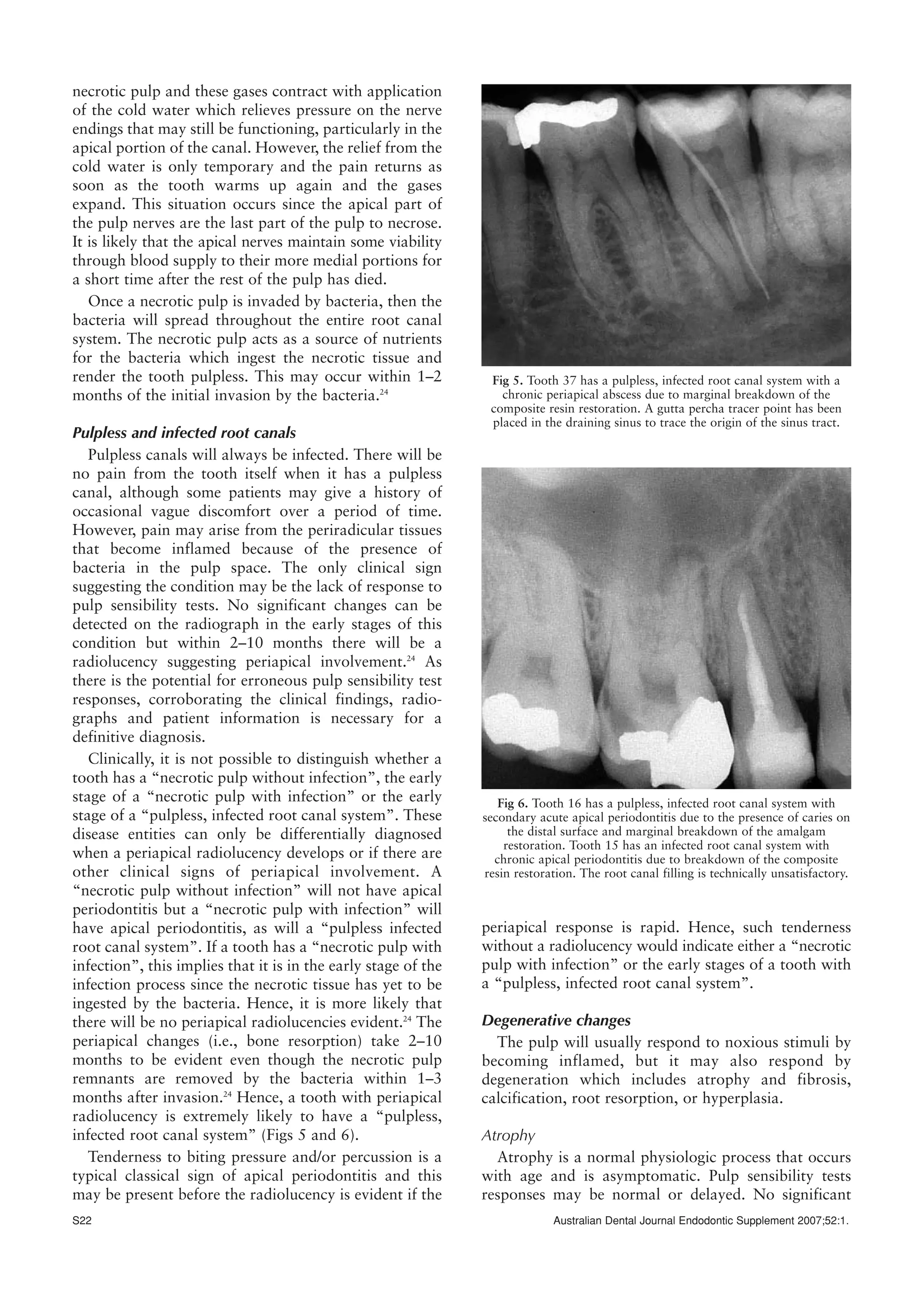 Art end clasificacion | PDF