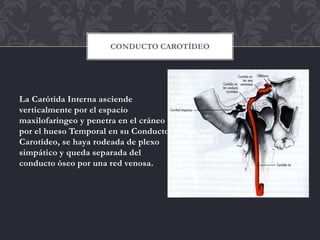 Arteria carotida interna y vertebral (ramas y terminales) | PPTX