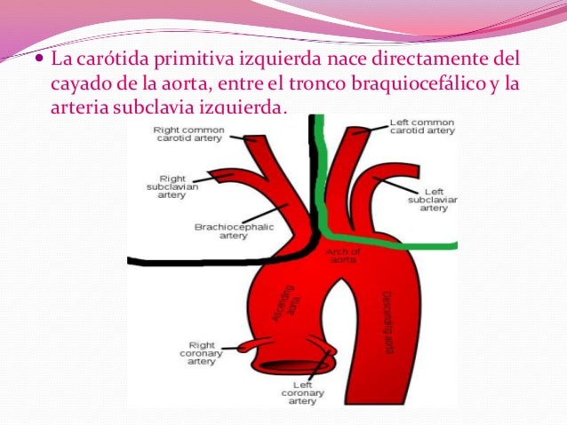 Arteria carotida primitiva
