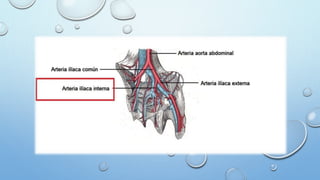 ARTERIA ILIACA EXTERNA.pptx