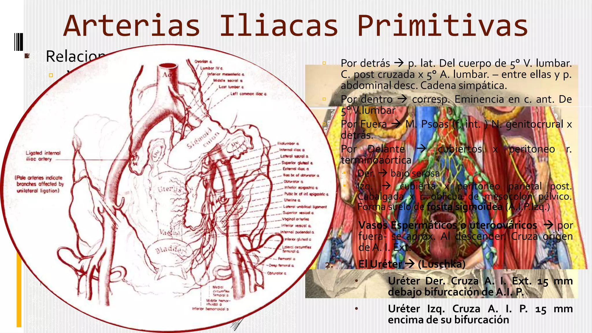 Anatomia de la Arteria Iliaca | PPTX