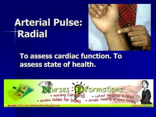 Arterial Pulse: Radial | PPT