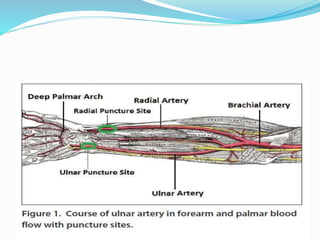 Arterial access of the upper limb | PPTX