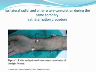 Arterial access of the upper limb | PPT
