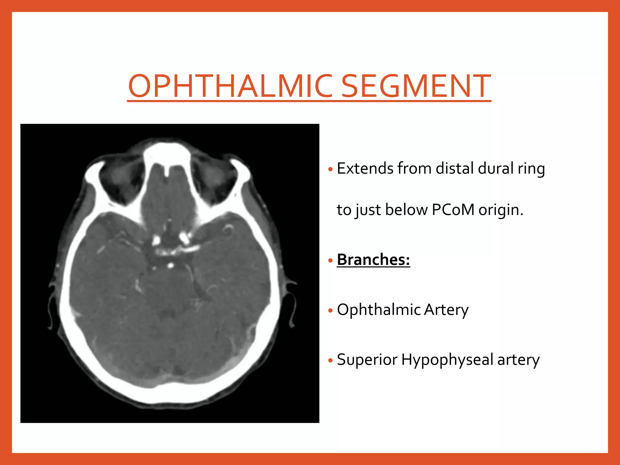 Arterial anatomy of Brain | PPTX
