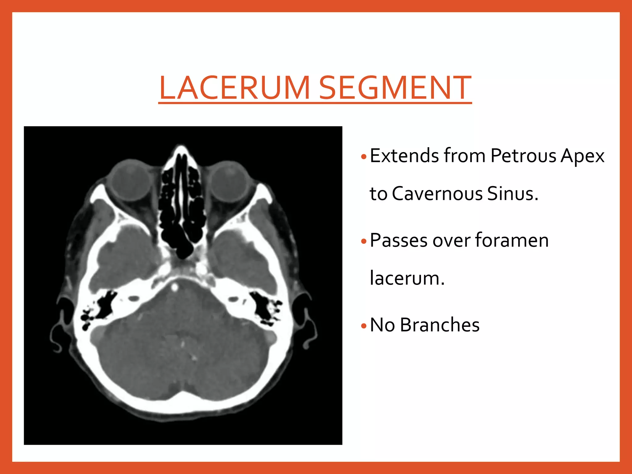 Arterial anatomy of Brain | PPTX