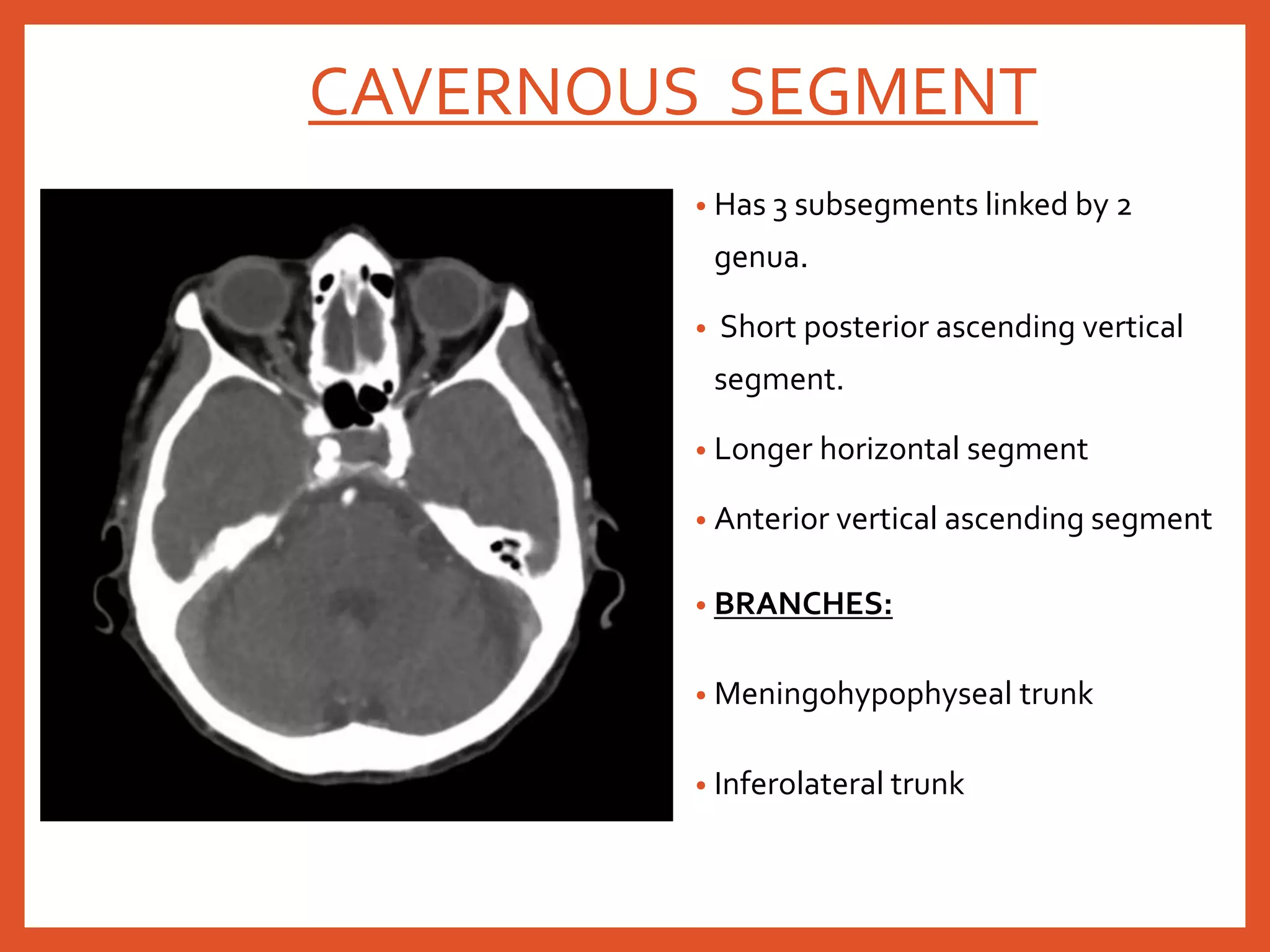 Arterial anatomy of Brain | PPTX