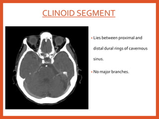 Arterial anatomy of Brain | PPTX | Brain and Nervous System Disorders ...