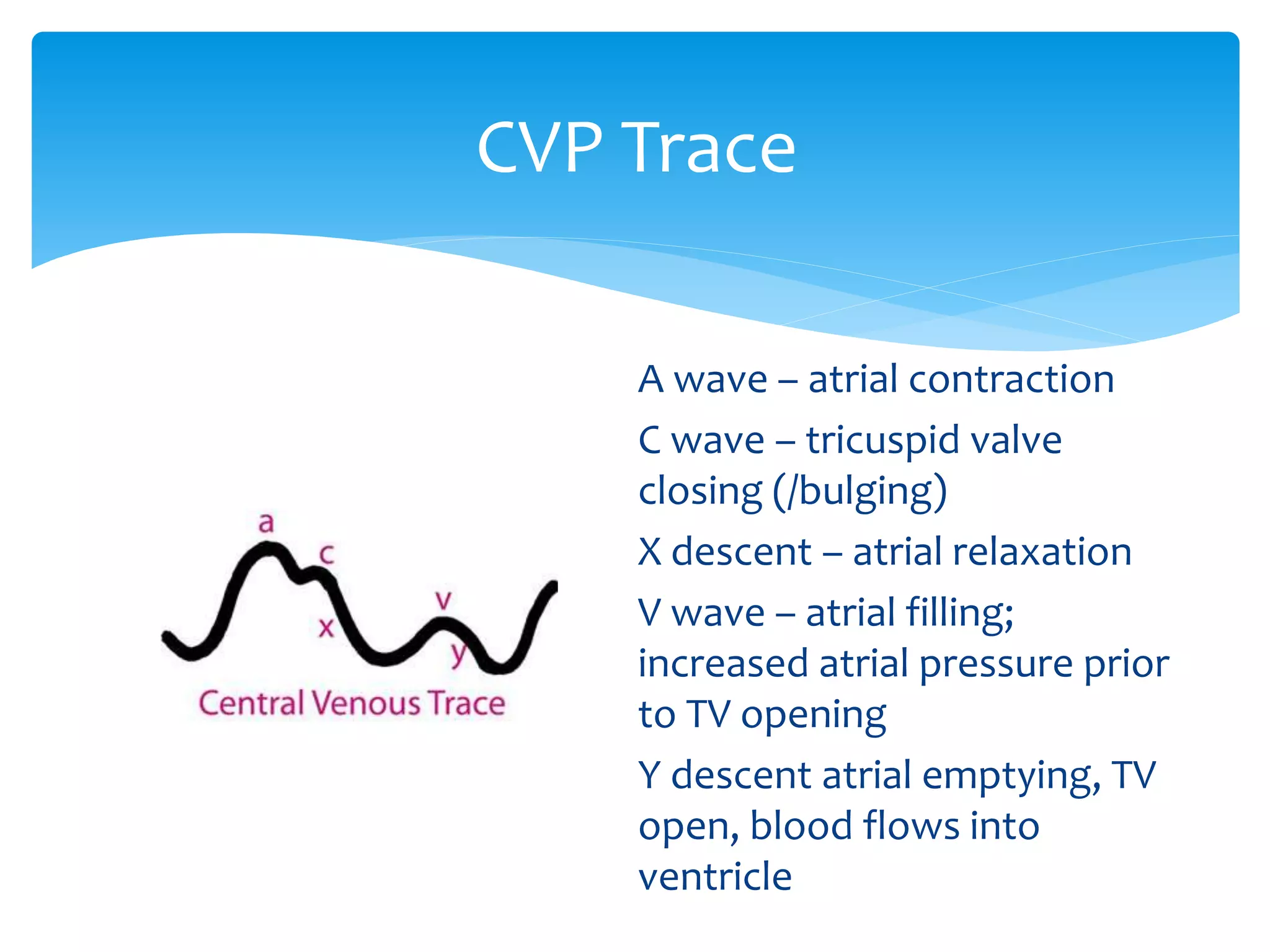 Arterial_and_CVP_monitoring.ppt