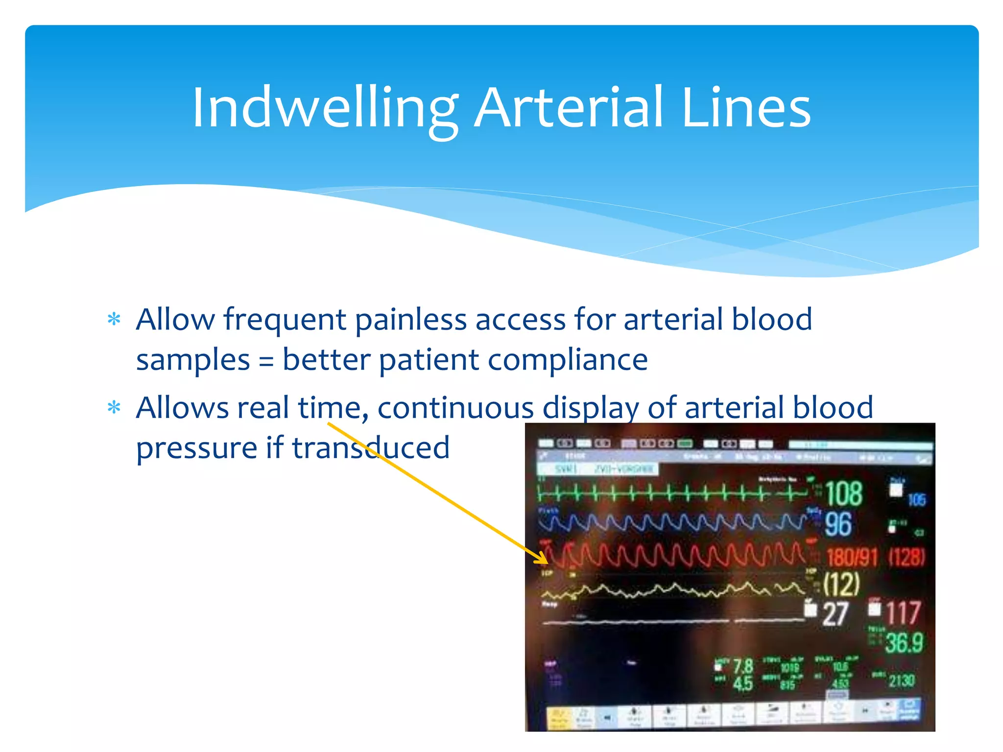Arterial_and_CVP_monitoring.ppt