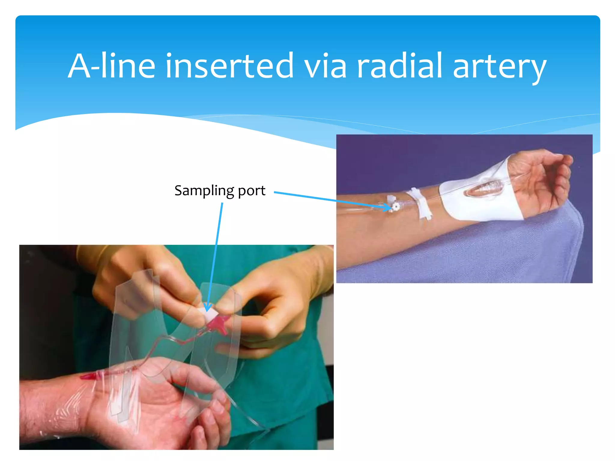 Arterial_and_CVP_monitoring.ppt