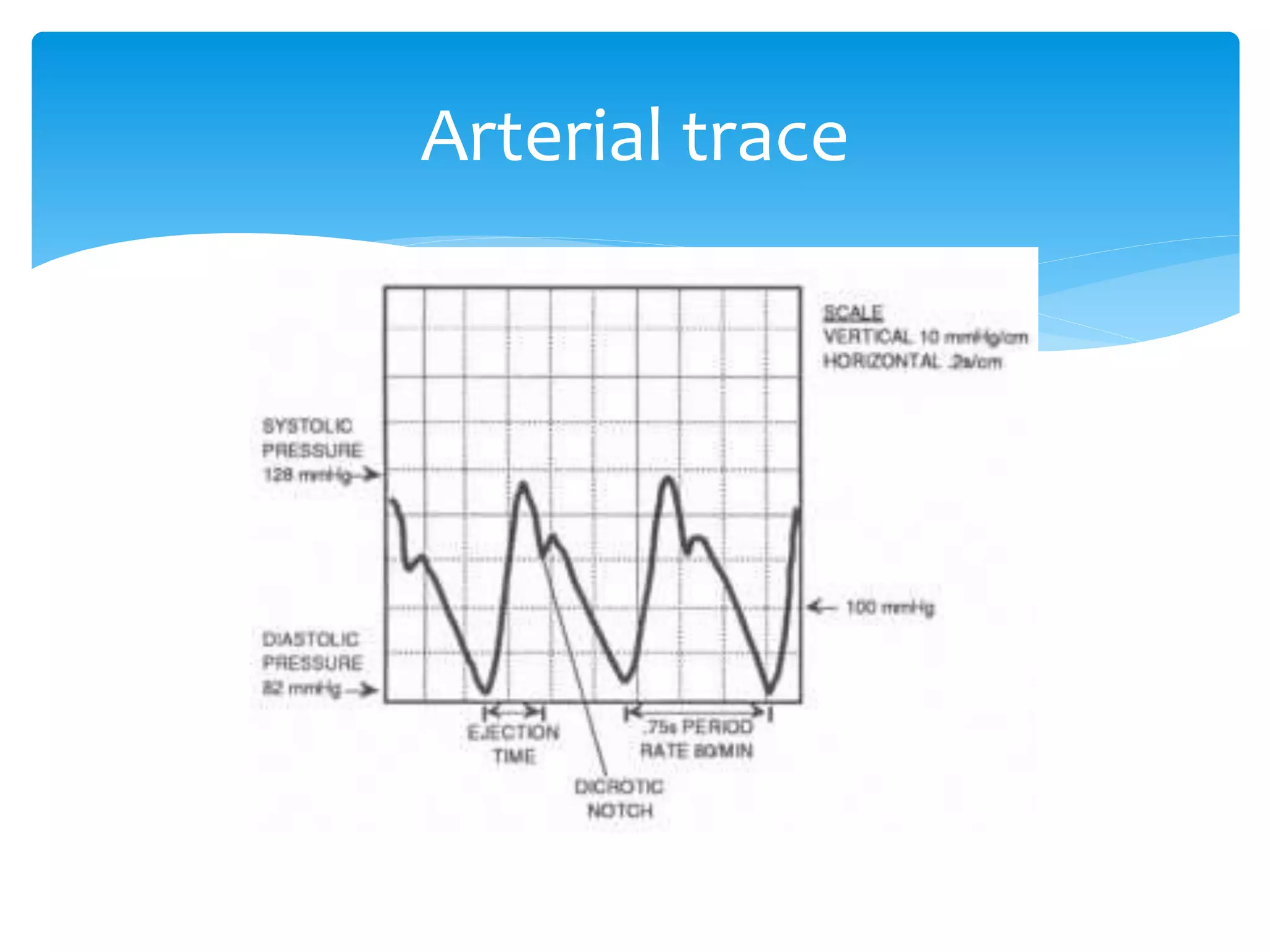 Arterial_and_CVP_monitoring.ppt