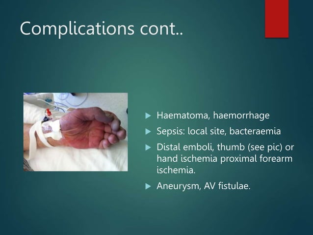 Arterial_and_CVP_monitoring.ppt